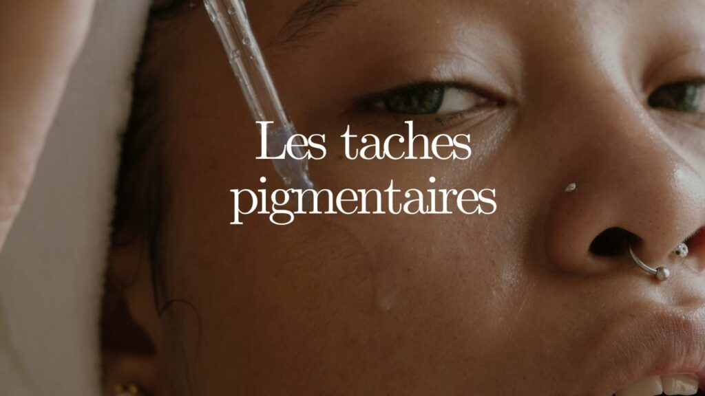 Comment se débarrasser des taches brunes sur le visage ? - exaalta